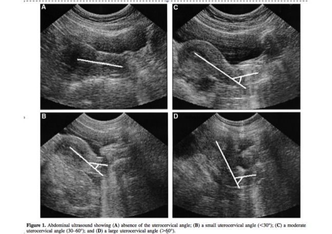 Top 10 interesting facts about ultrasound-guided embryo transfer