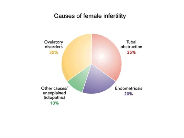 Top 10 Facts about Tubal Factor Infertility