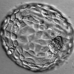 Timeline with images of embryo development in IVF