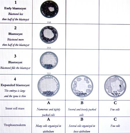 Understanding the Blastocyst Grading Scale | The IVF Process