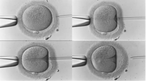 ICSI IVF – What Is It And Why Is It Used?