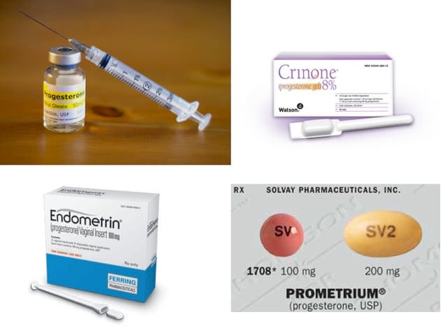 Top 10 Facts About Vaginal Progesterone and Assisted Reproductive ...